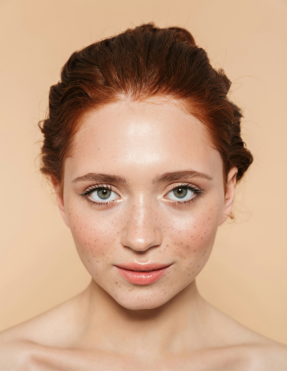 Acne Treatments - Cosmedicare