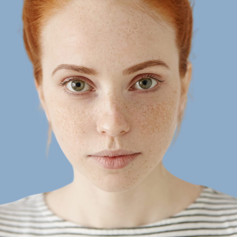 Rosacea Treatments - Cosmedicare