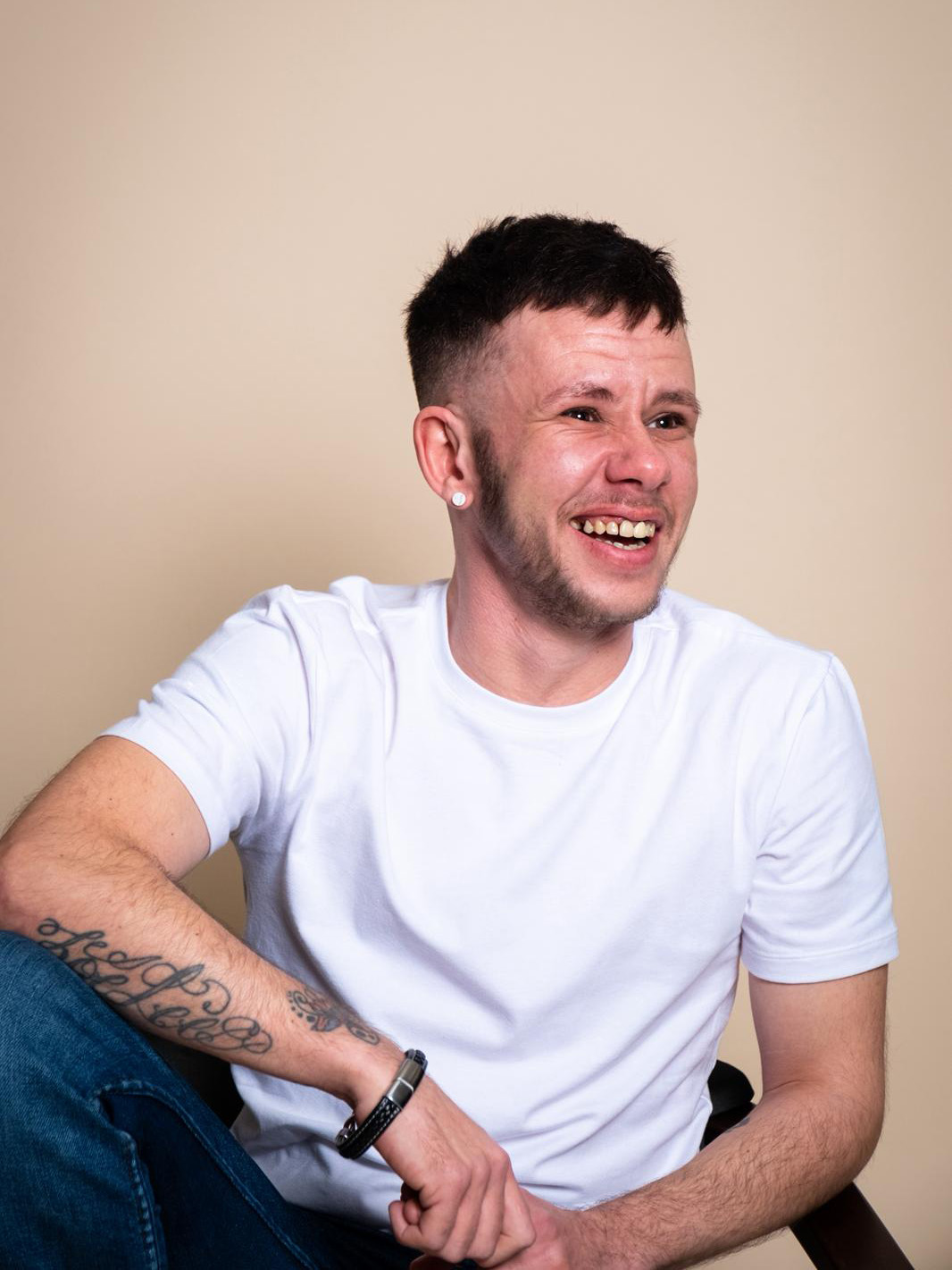 Transgender Reconstruction Chest Surgery - Cosmedicare